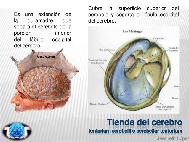 El cerebro