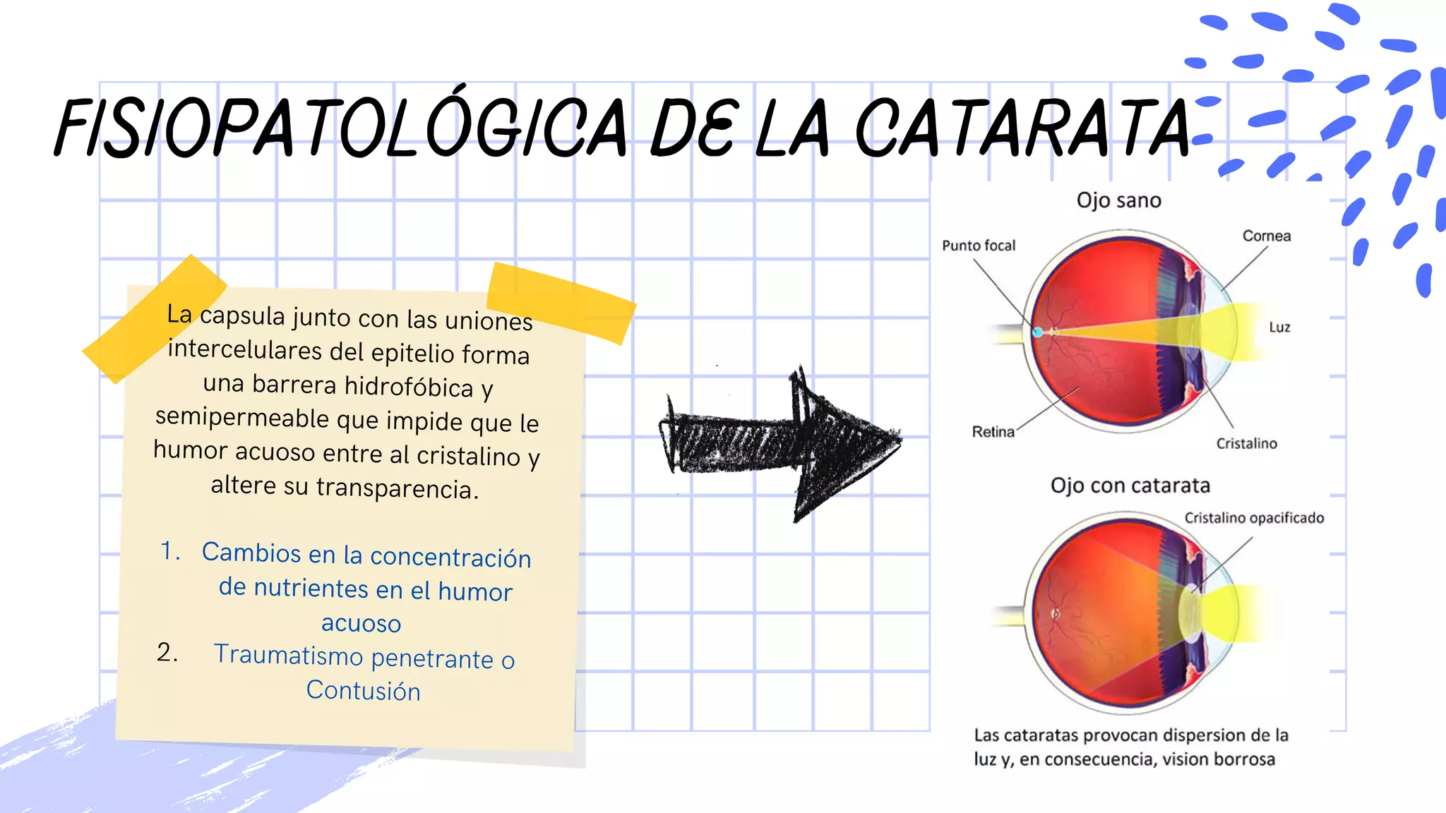 el cristalino y sus alteraciones patológicas #1.pdf