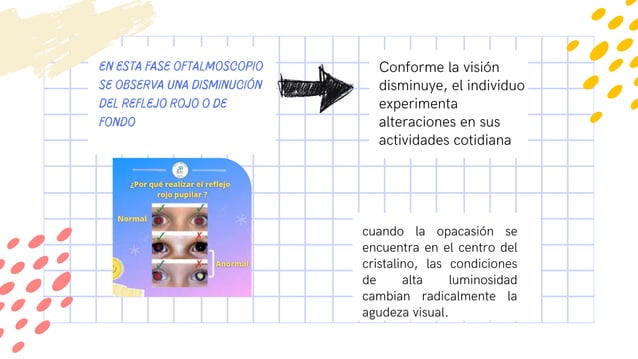 el cristalino y sus alteraciones patológicas #1.pdf