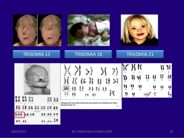 El cromosoma. DR. RAUL JUAREZ.