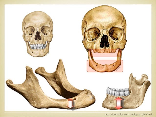Padrão de Envelhecimento Mandibular e Maxilar