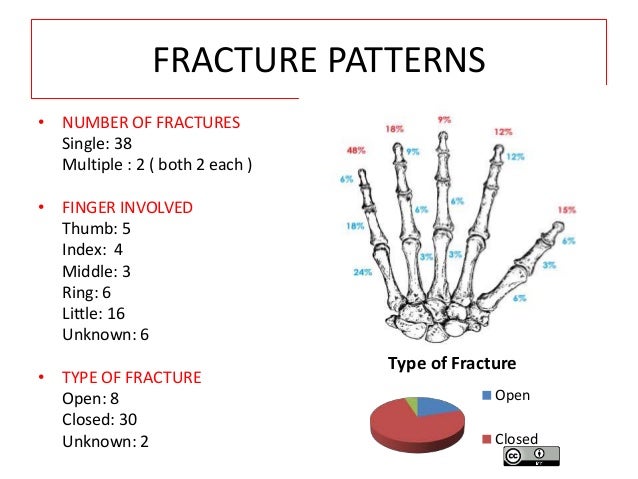 Elderly hand fractures singapore 2015 rauma conference v2.0