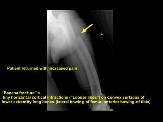 Radiology Rounds: Elderly male with leg pain | PPT