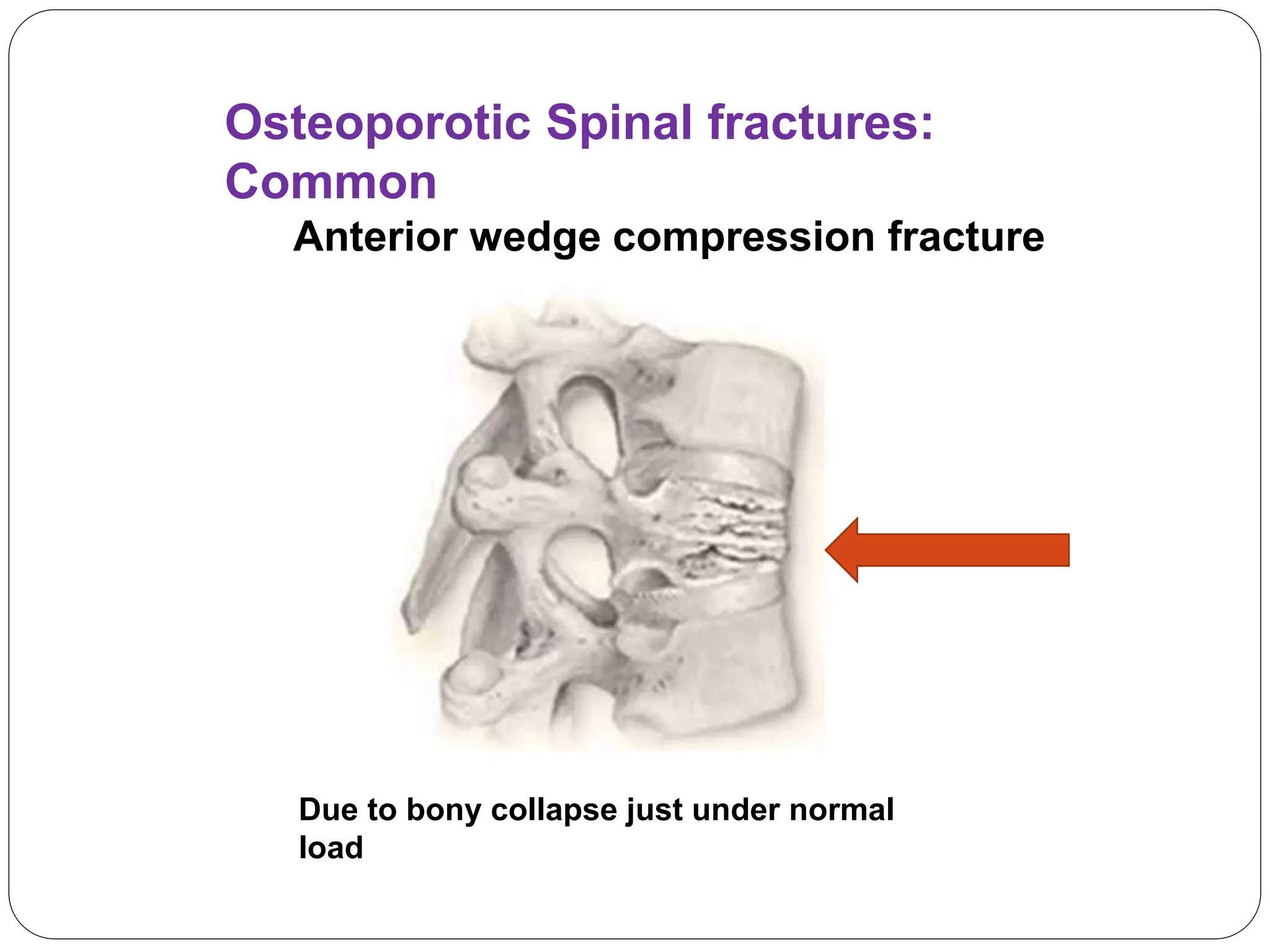 Common Musculoskeletal (orthopedic) disorders in elderly | PPTX