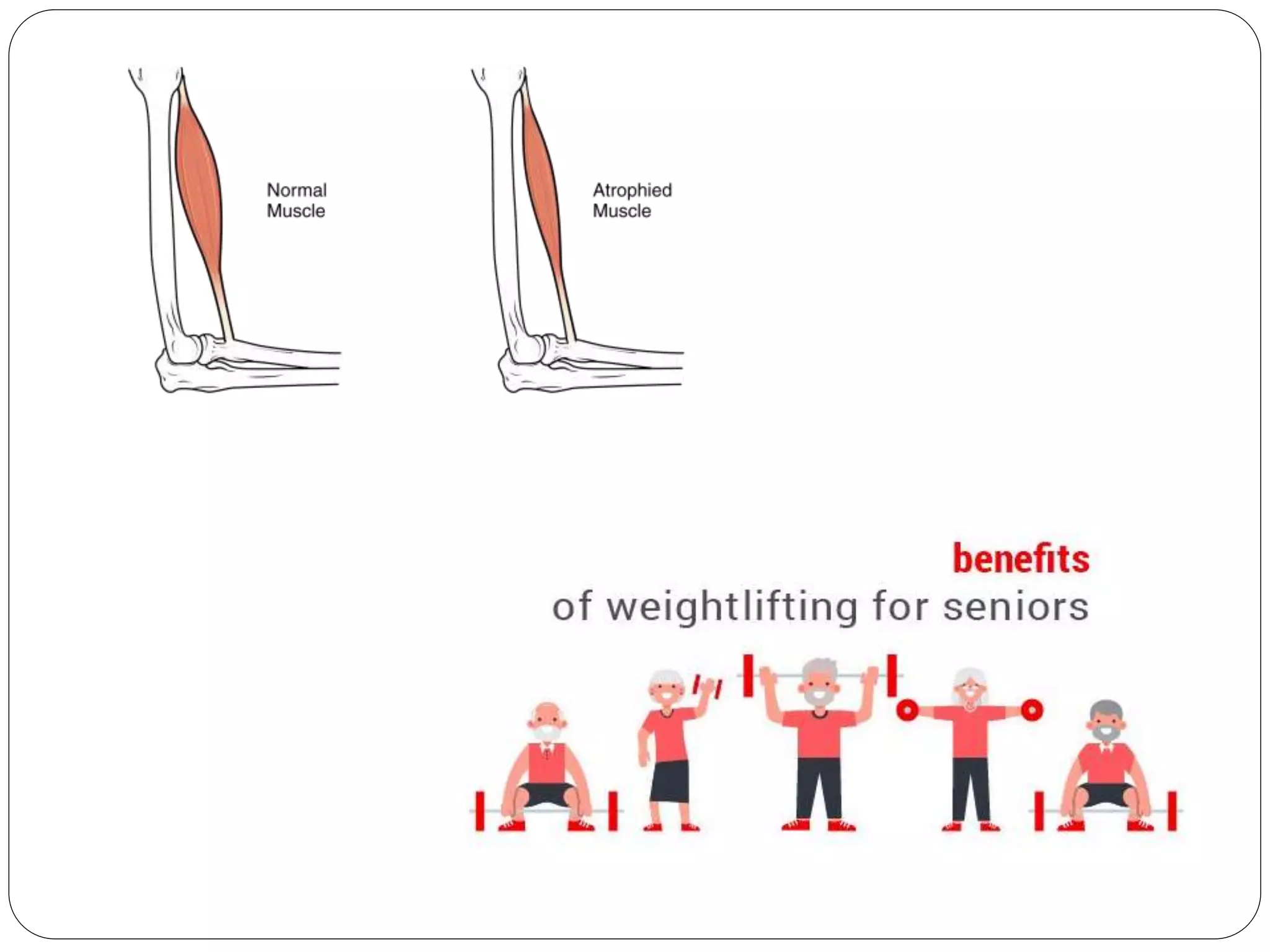 Common Musculoskeletal (orthopedic) disorders in elderly | PPTX