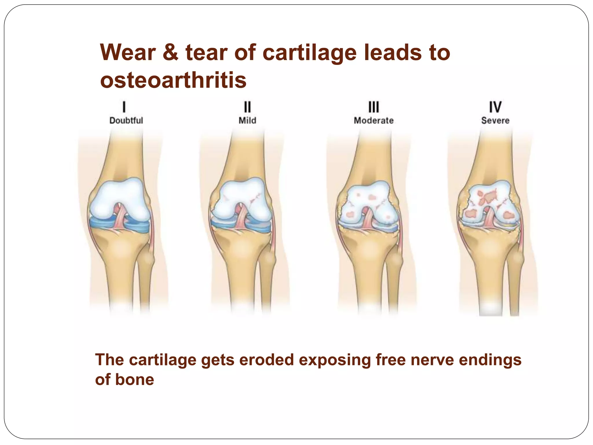 Common Musculoskeletal (orthopedic) disorders in elderly | PPTX