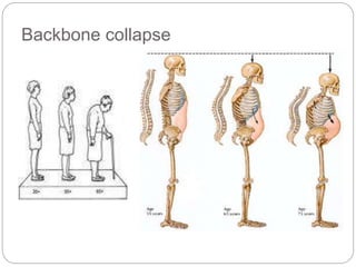Common Musculoskeletal (orthopedic) disorders in elderly | PPTX