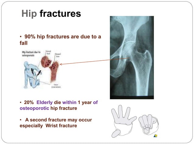 Common Musculoskeletal (orthopedic) disorders in elderly | PPTX