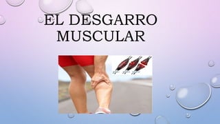 El desgarro muscular, luxacion,fractura.pptx