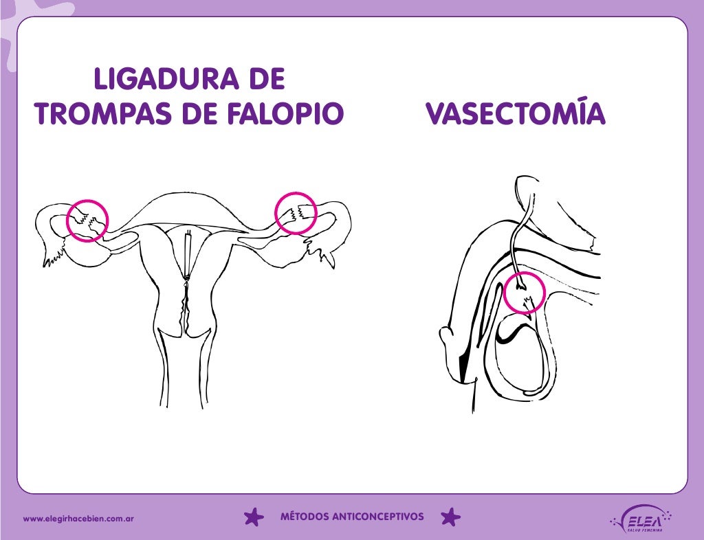Métodos Anticonceptivos [www.elegirhacebien.com.ar]