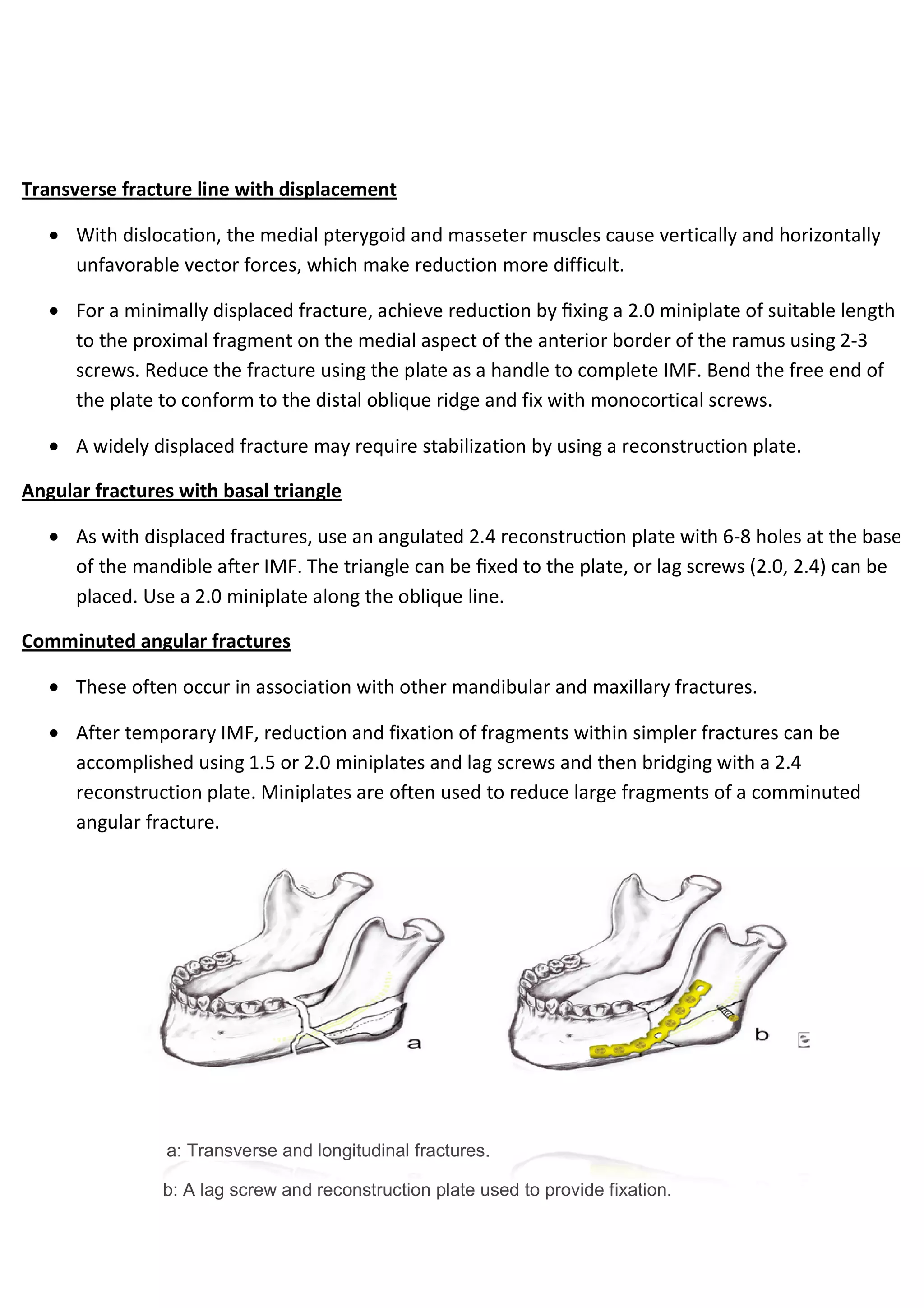 Symphysis & Angle MANDIBULAR FRACTURES | PDF