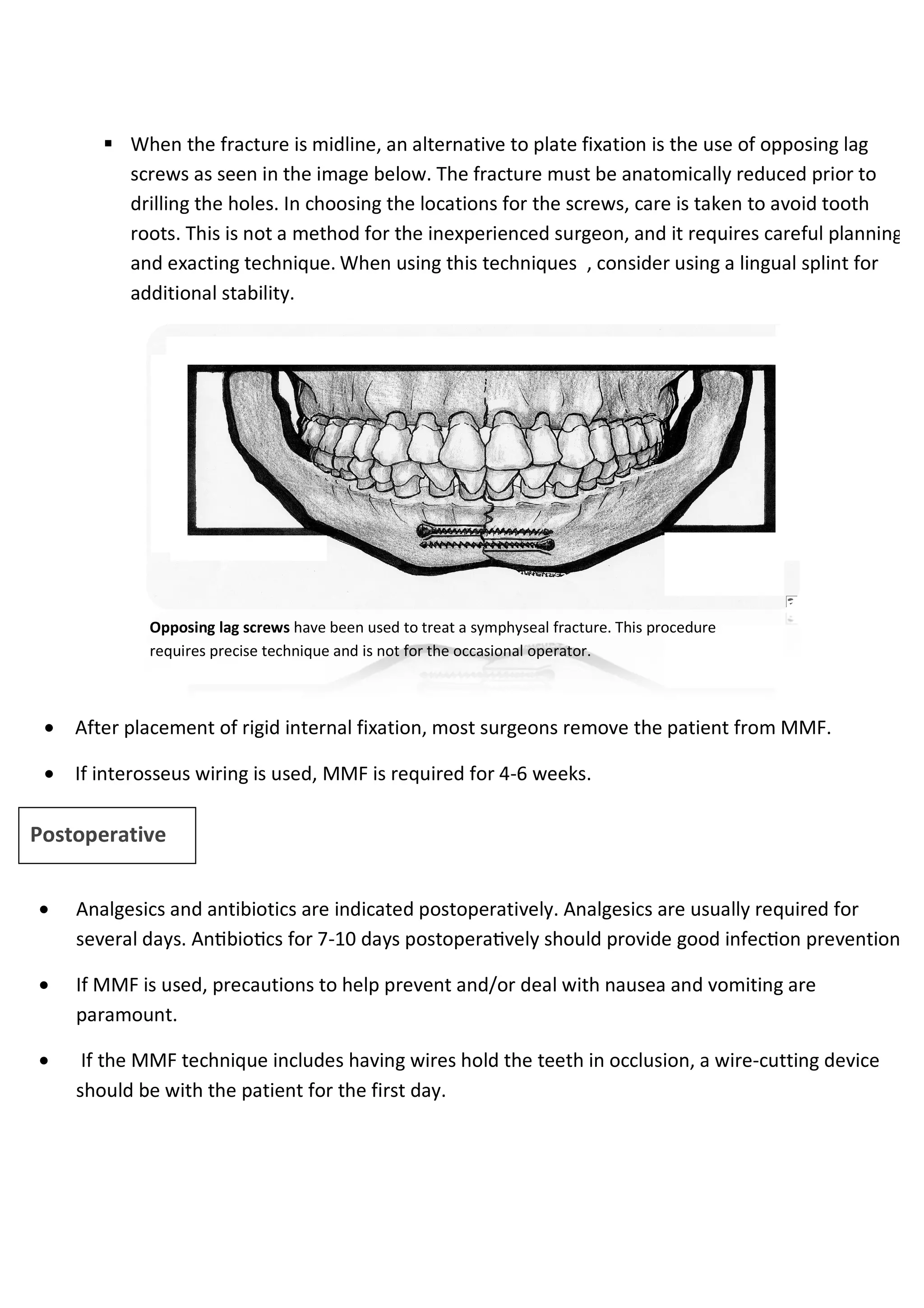 Symphysis & Angle MANDIBULAR FRACTURES | PDF