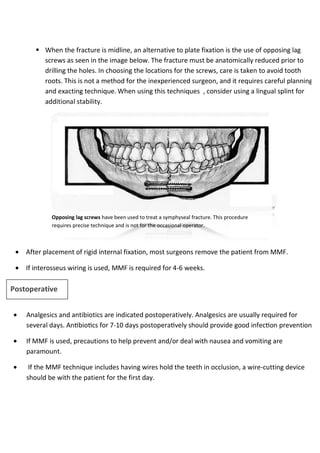 Symphysis & Angle MANDIBULAR FRACTURES | PDF