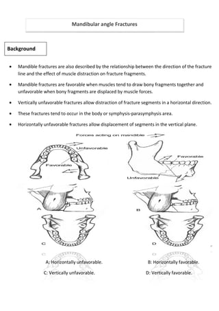 Symphysis & Angle MANDIBULAR FRACTURES | PDF