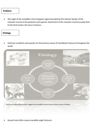 Symphysis & Angle MANDIBULAR FRACTURES | PDF