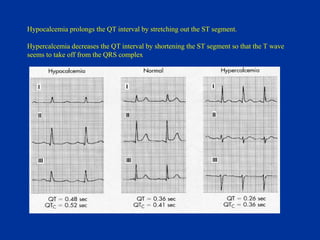 Metabolic Abnormalities in Surgery point of view | PPT