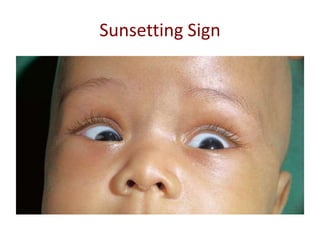 Elective neurosurgery | PPT