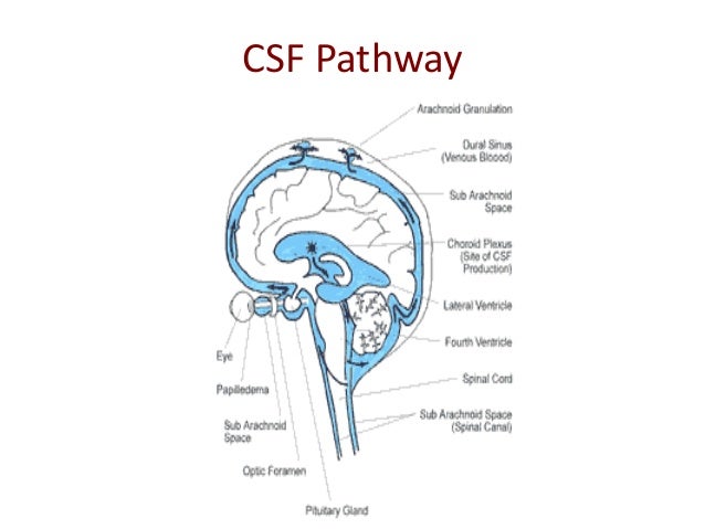 Elective neurosurgery