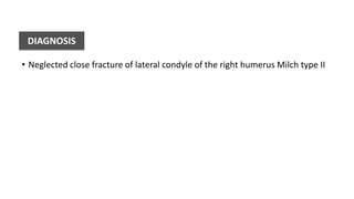 Elective Pediatrics - Pediatric Elbow Fractures_LIM (1).pptx