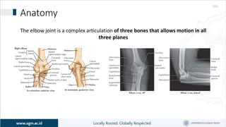 Elective Pediatrics - Pediatric Elbow Fractures_LIM (1).pptx