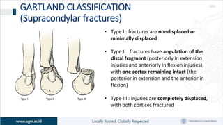 Elective Pediatrics - Pediatric Elbow Fractures_LIM (1).pptx