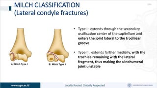 Elective Pediatrics - Pediatric Elbow Fractures_LIM (1).pptx