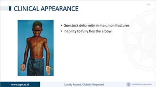 Elective Pediatrics - Pediatric Elbow Fractures_LIM (1).pptx