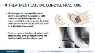 Elective Pediatrics - Pediatric Elbow Fractures_LIM (1).pptx