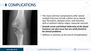 Elective Pediatrics - Pediatric Elbow Fractures_LIM (1).pptx