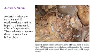 ELECTIVE SPLENECTOMY.pptx