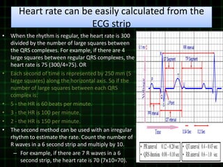 Electocardiography by aamir sharif | PPTX