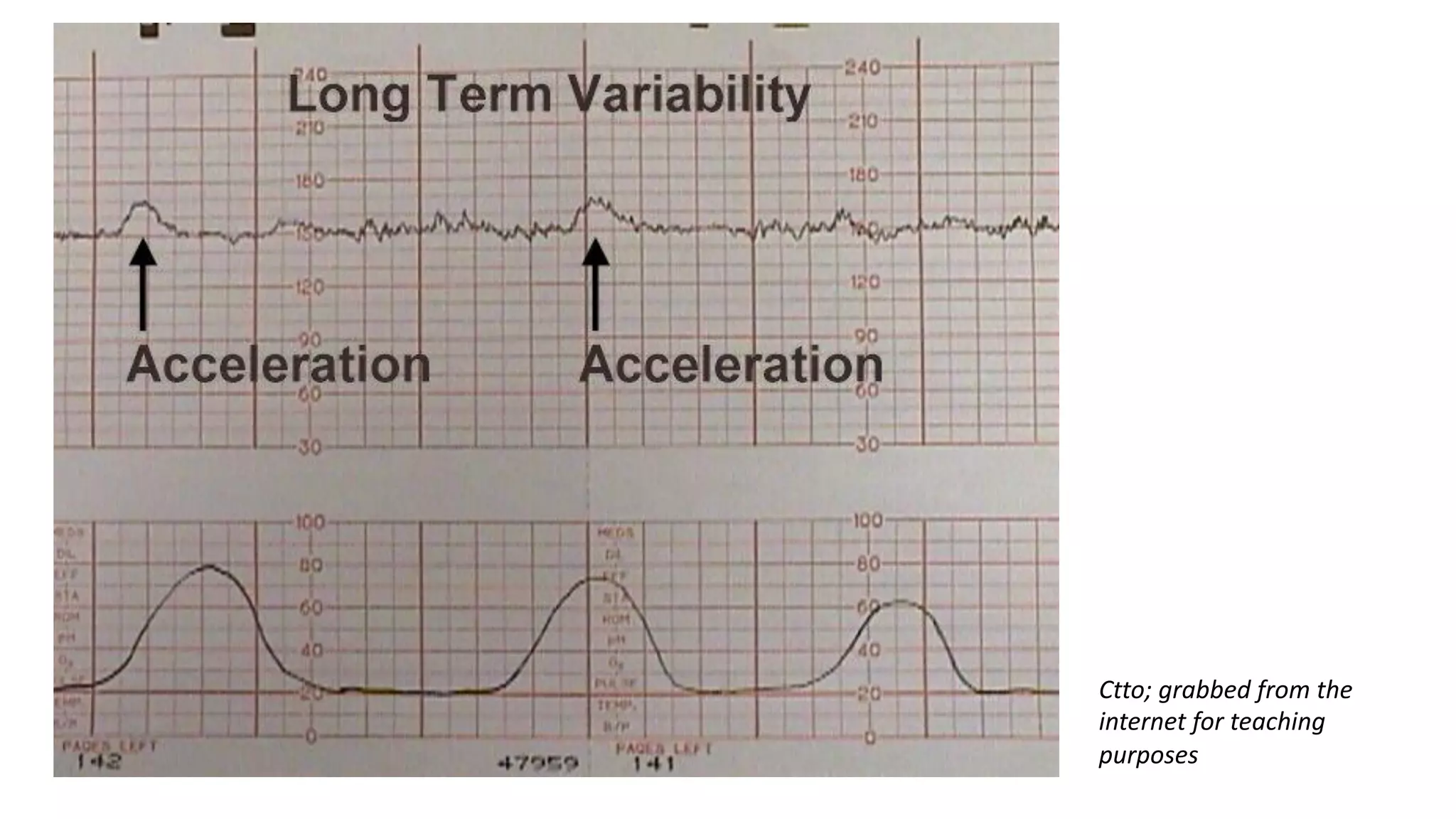electonic-fetal-monitoring-sgd.pdf
