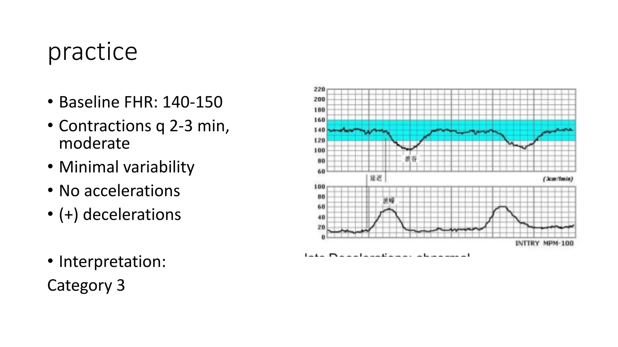 electonic-fetal-monitoring-sgd.pdf