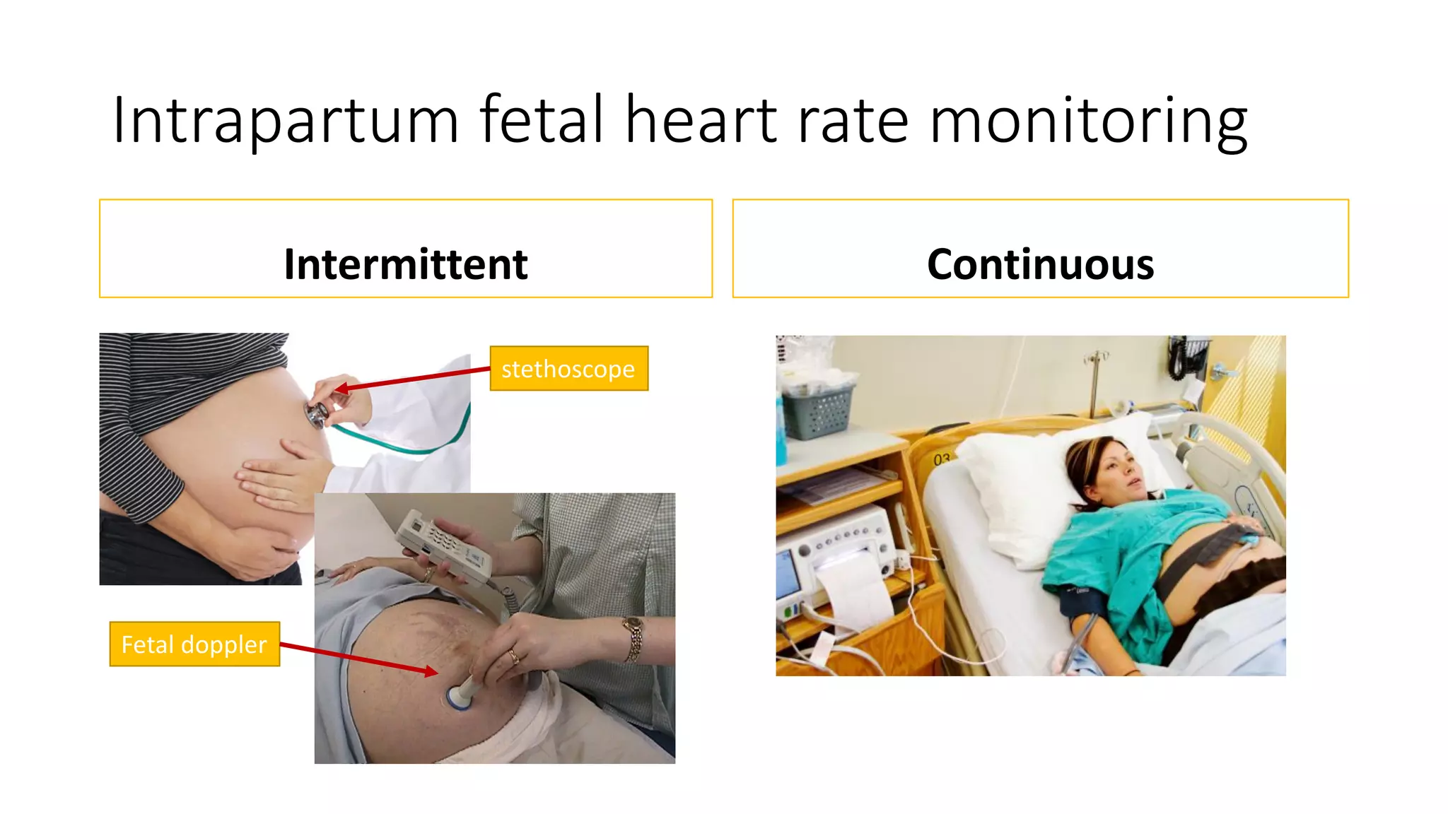 electonic-fetal-monitoring-sgd.pdf