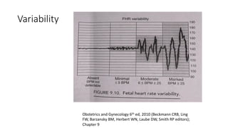 electonic-fetal-monitoring-sgd.pdf