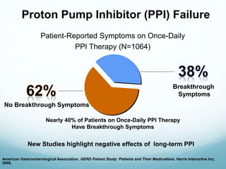 Eletro Stimulation of Lower Esophageal Sphincter on GERD treatment | PPTX