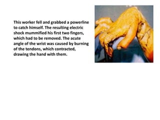 electricity and human body | PPTX