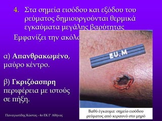 ΕΓΚΑΥΜΑΤΑ: ΗΛΕΚΤΡΙΚΑ ΕΓΚΑΥΜΑΤΑ | PPTX