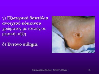 ΕΓΚΑΥΜΑΤΑ: ΗΛΕΚΤΡΙΚΑ ΕΓΚΑΥΜΑΤΑ | PPTX