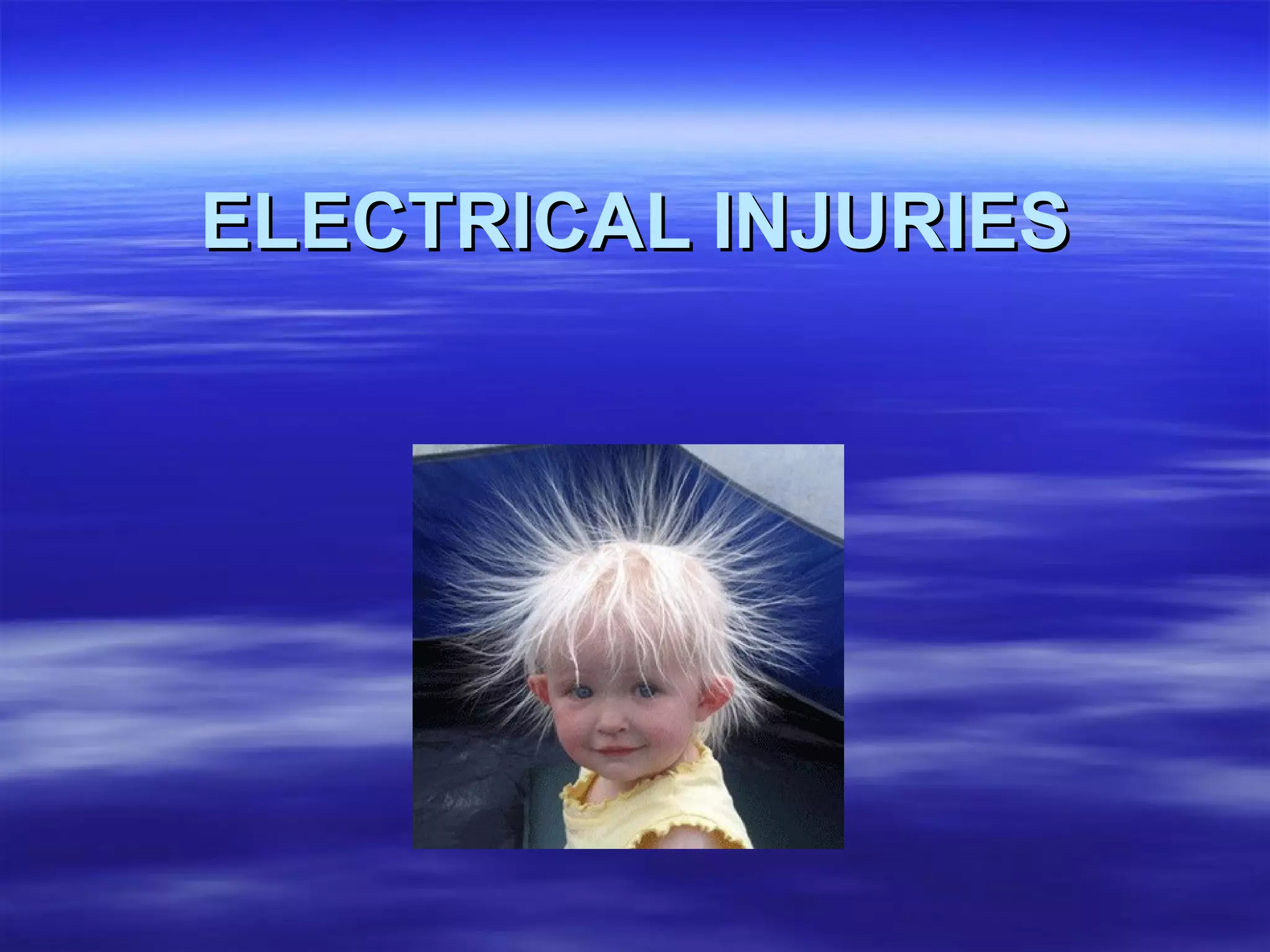 Electrical Injuries | PPT