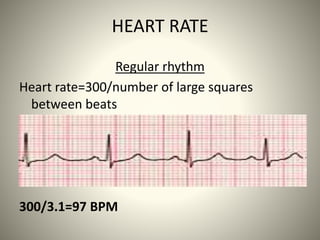 Electrical activity of heart | PPTX
