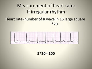 Electrical activity of heart | PPTX