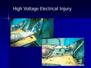 Electrical Campaign Presentation | PDF