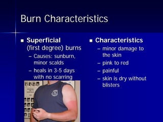 Electrical Campaign Presentation | PDF