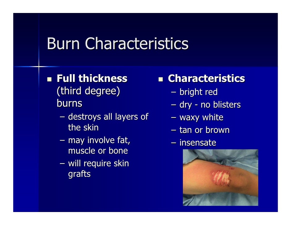 Electrical Campaign Presentation