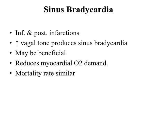 Electrical complications of mi | PPT