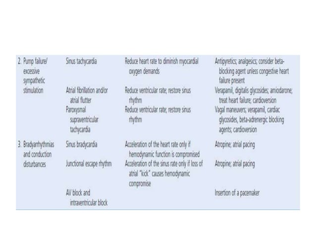 Electrical complications of mi | PPT