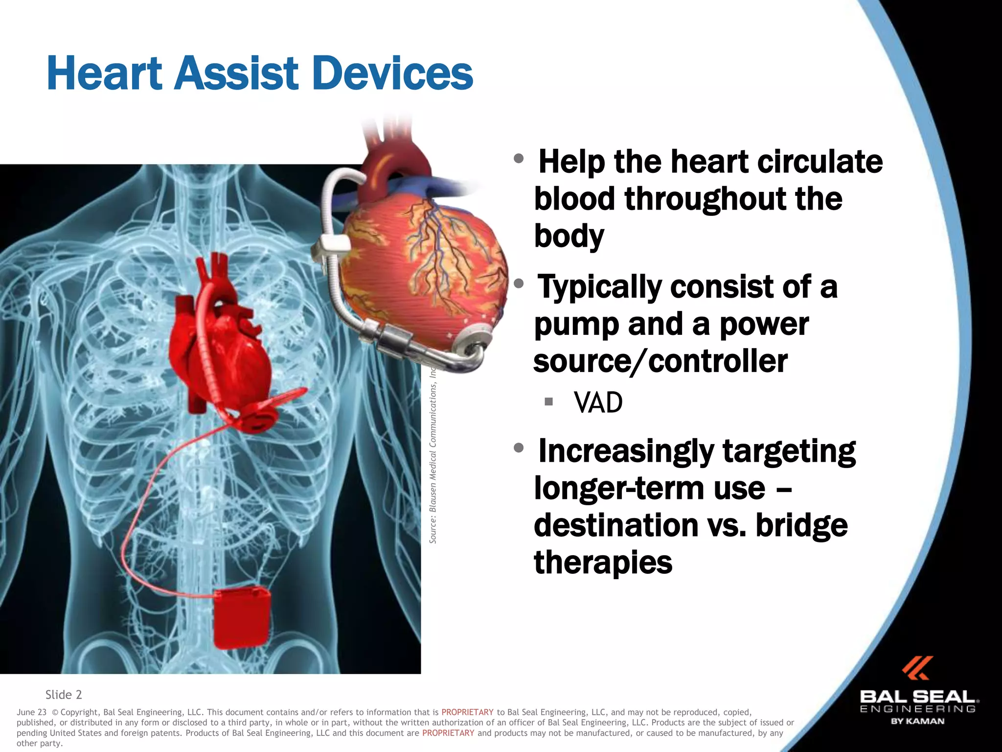 Electrical Contact Selection for Heart Assist Device Design | PPT