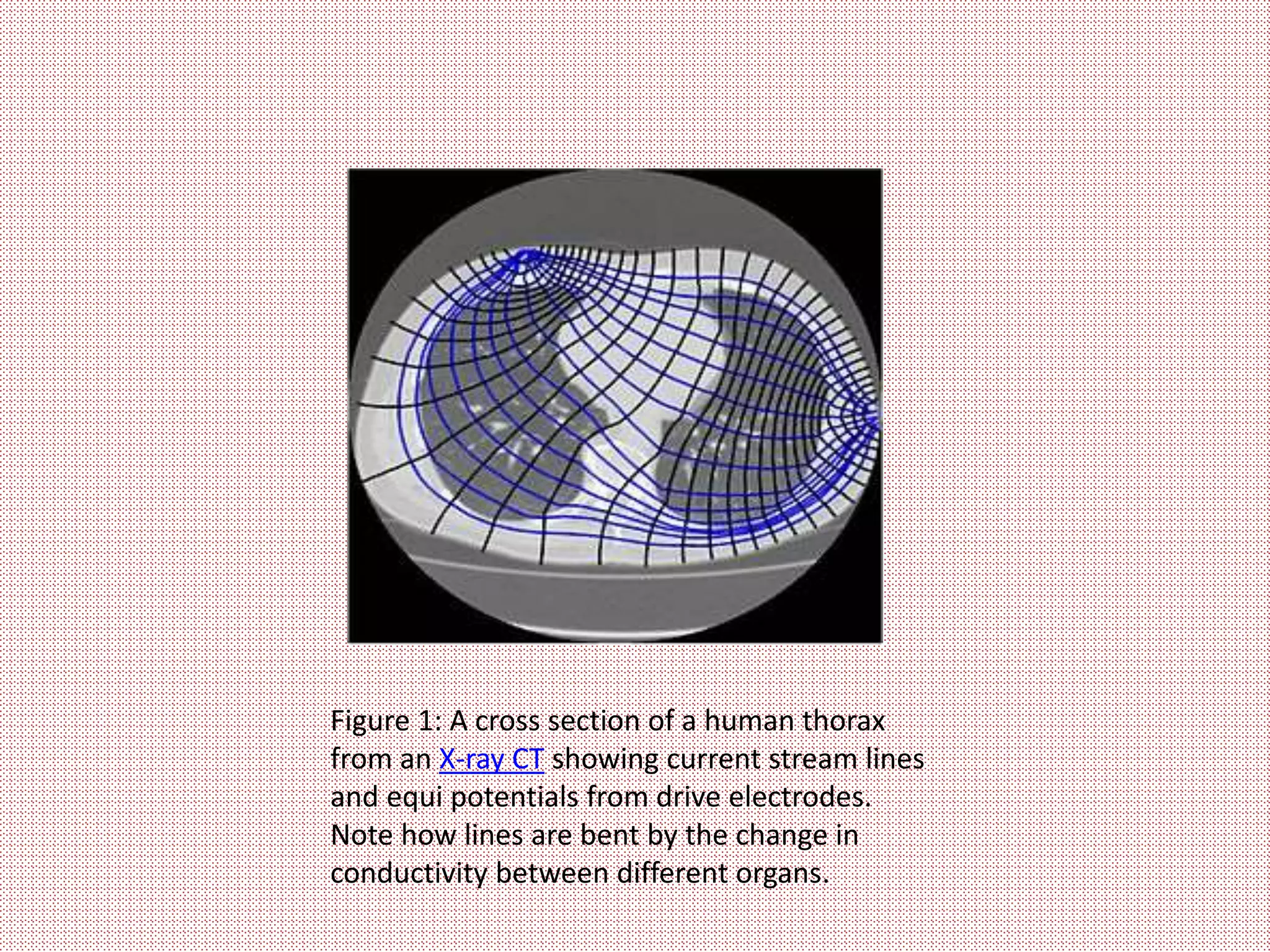 Electrical impedance tomography | PPTX