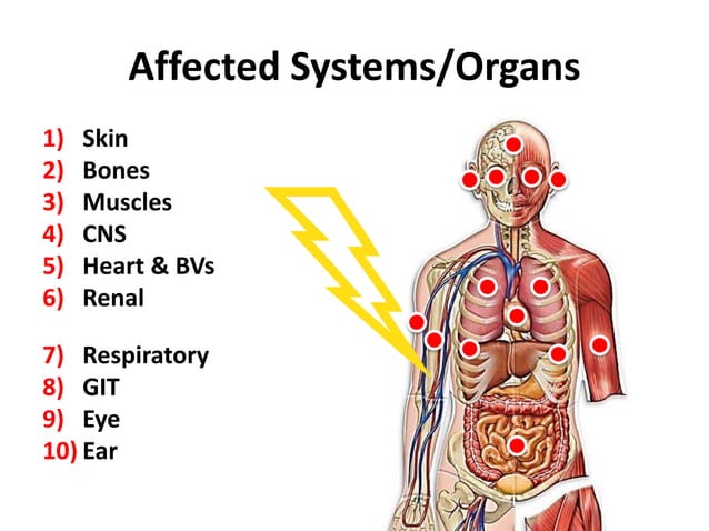 Electrical injuries | PPTX | Injuries | Diseases and Conditions